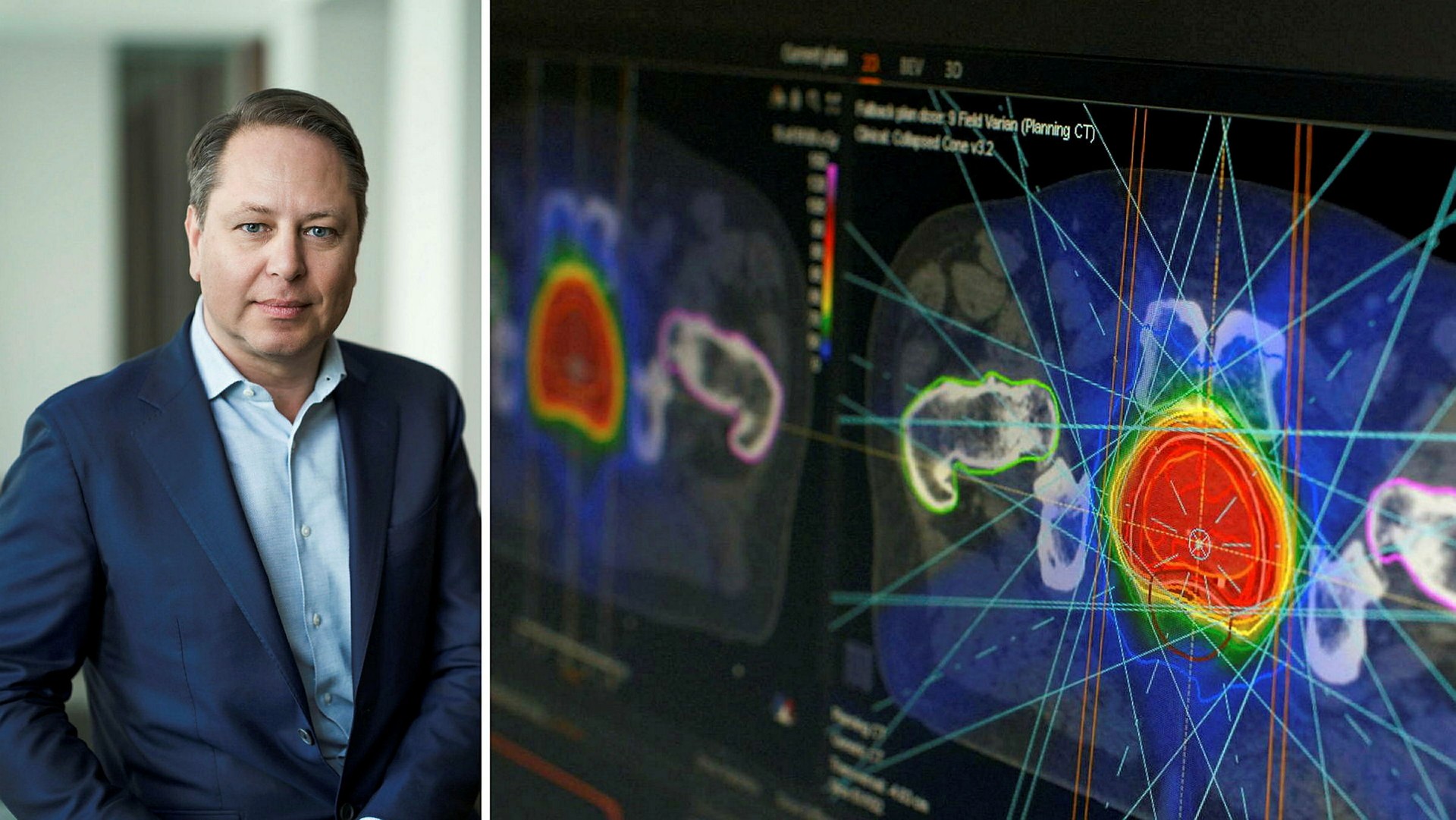 Raysearch får ny USA-order – steg kraftigt inför stängning